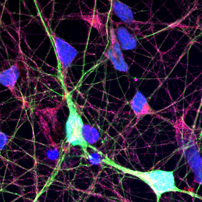human stem cell-derived neuron [IMAGE] | EurekAlert! Science News Releases