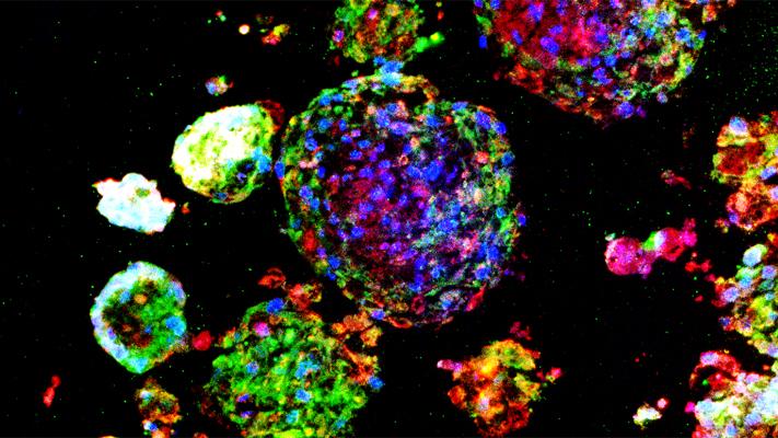 Lung Spheroid [IMAGE] | EurekAlert! Science News Releases