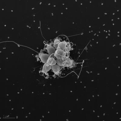 Choanoflagellate Colony [IMAGE] | EurekAlert! Science News Releases
