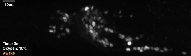 How Worms Switch Between Alert and Sleep Stat | EurekAlert!