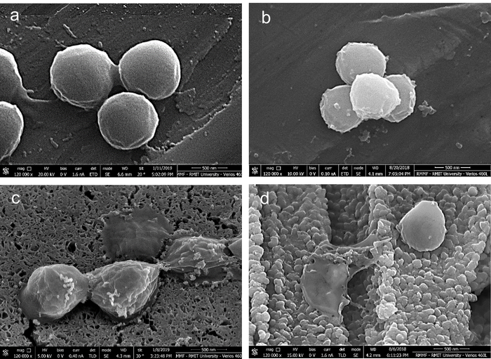 Rapid killing of golden staph [IMAGE] | EurekAlert! Science News Releases