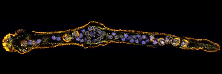 Parasite revealed: New insights into dicyemid | EurekAlert!