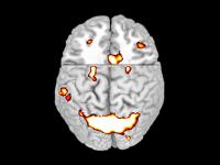 For easy tasks, brain preps and decides toget | EurekAlert!