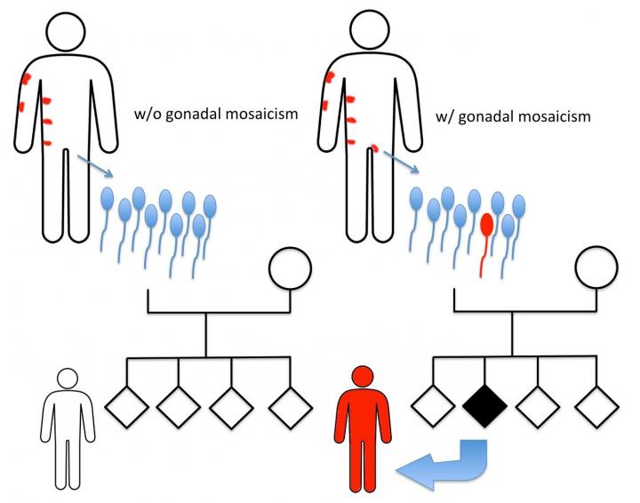Skin disease caused by sperm cell transmissio | EurekAlert!