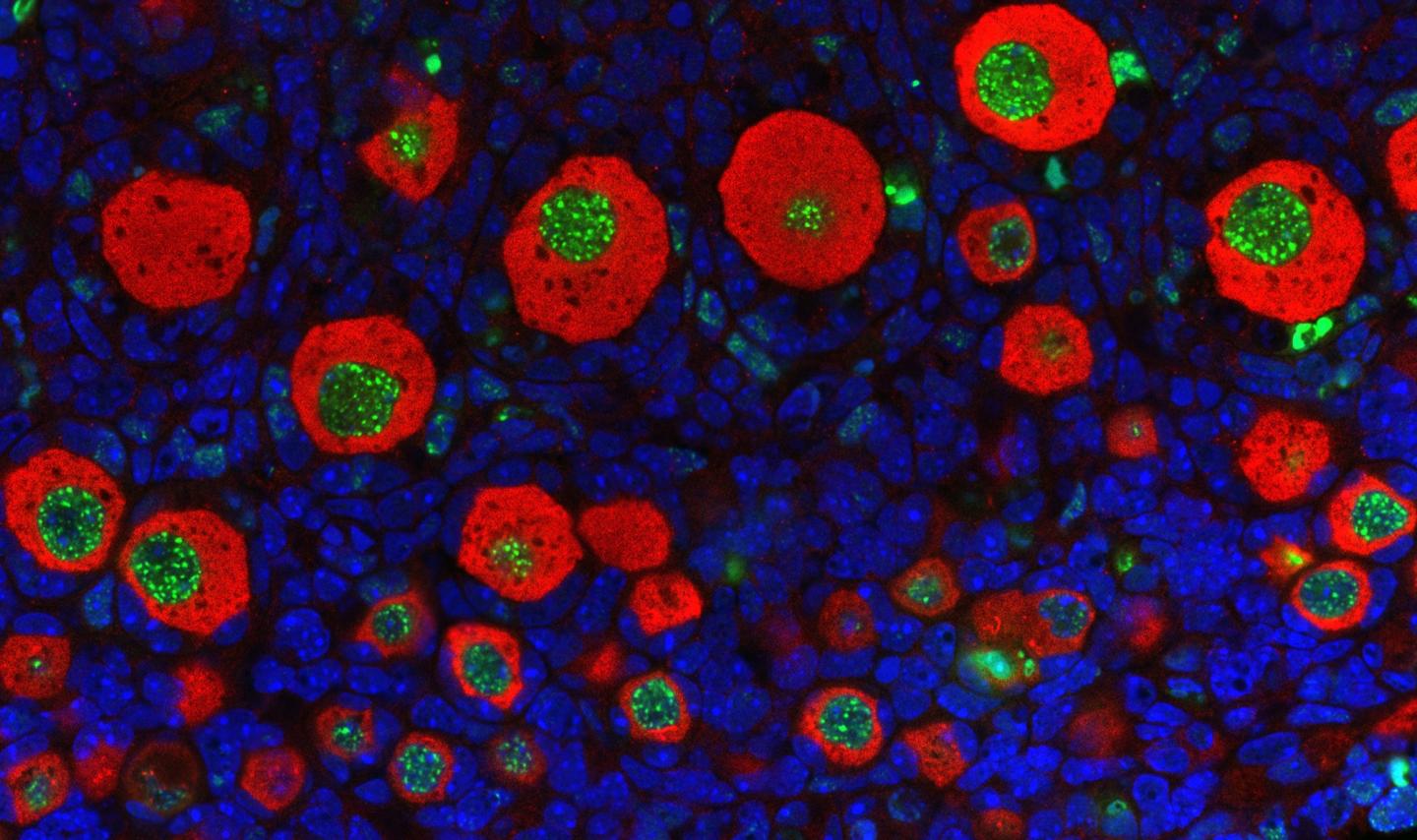 DNA Damage in Mouse Ovary Trea [IMAGE] | EurekAlert! Science News Releases