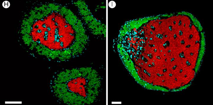 Bacteriome of a Cicada's Gut [IMAGE] | EurekAlert! Science News Releases