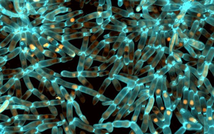 Evolved snowflake yeast [IMAGE] | EurekAlert! Science News Releases