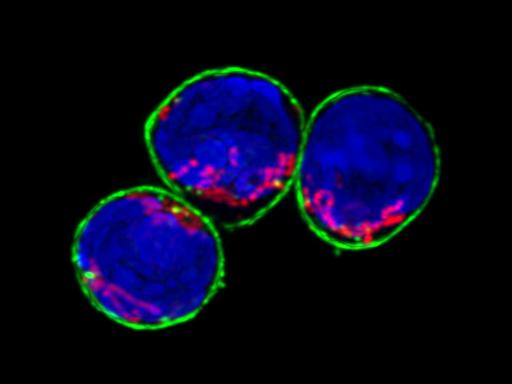 Microscopic Image of Th17 Cell [IMAGE] | EurekAlert! Science News Releases