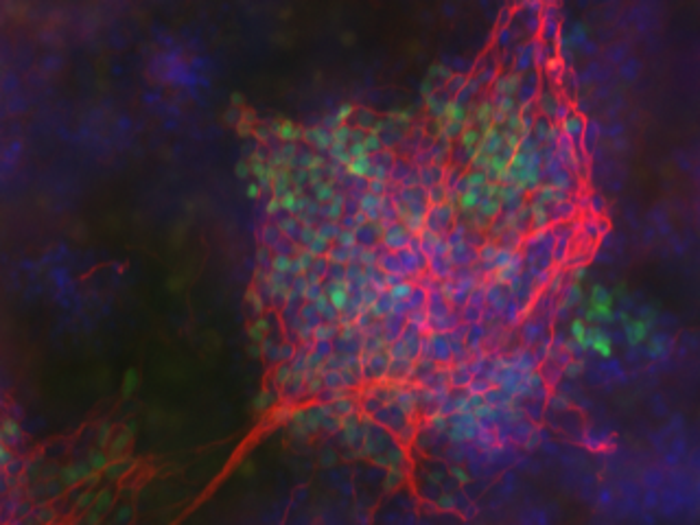 Sugared proteins called proteo [IMAGE] | EurekAlert! Science News Releases
