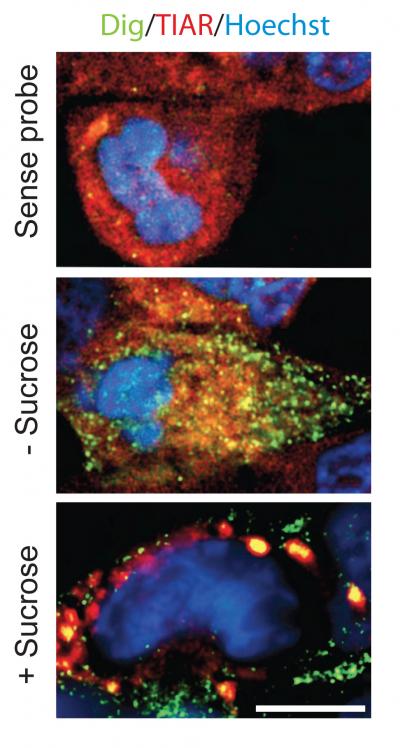 Lighting Up RNA in Living Cells (3 of 7) | EurekAlert!