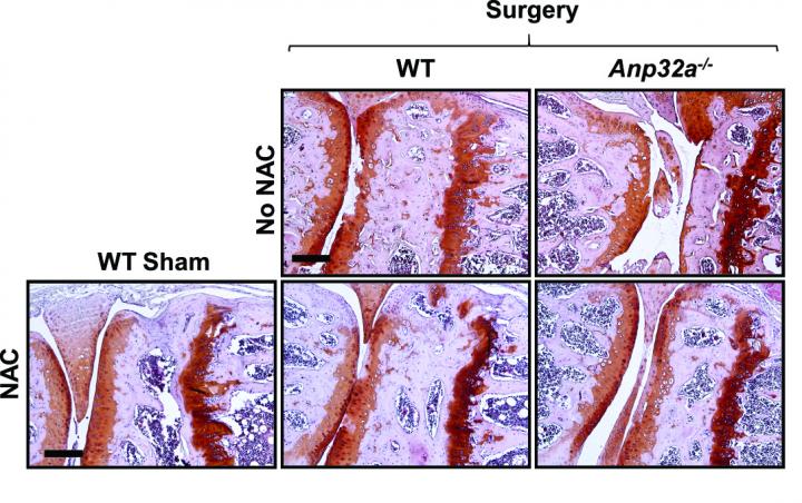 Antioxidant defender protects against osteoar | EurekAlert!