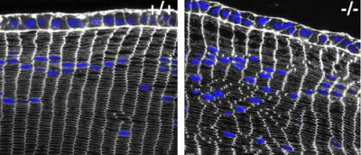 Arrangement of Lens Fiber Cell [IMAGE] | EurekAlert! Science News Releases