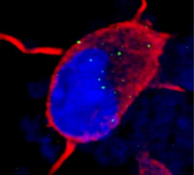 Toxic RNA Foci in C9ORF72 iPS [IMAGE] | EurekAlert! Science News Releases