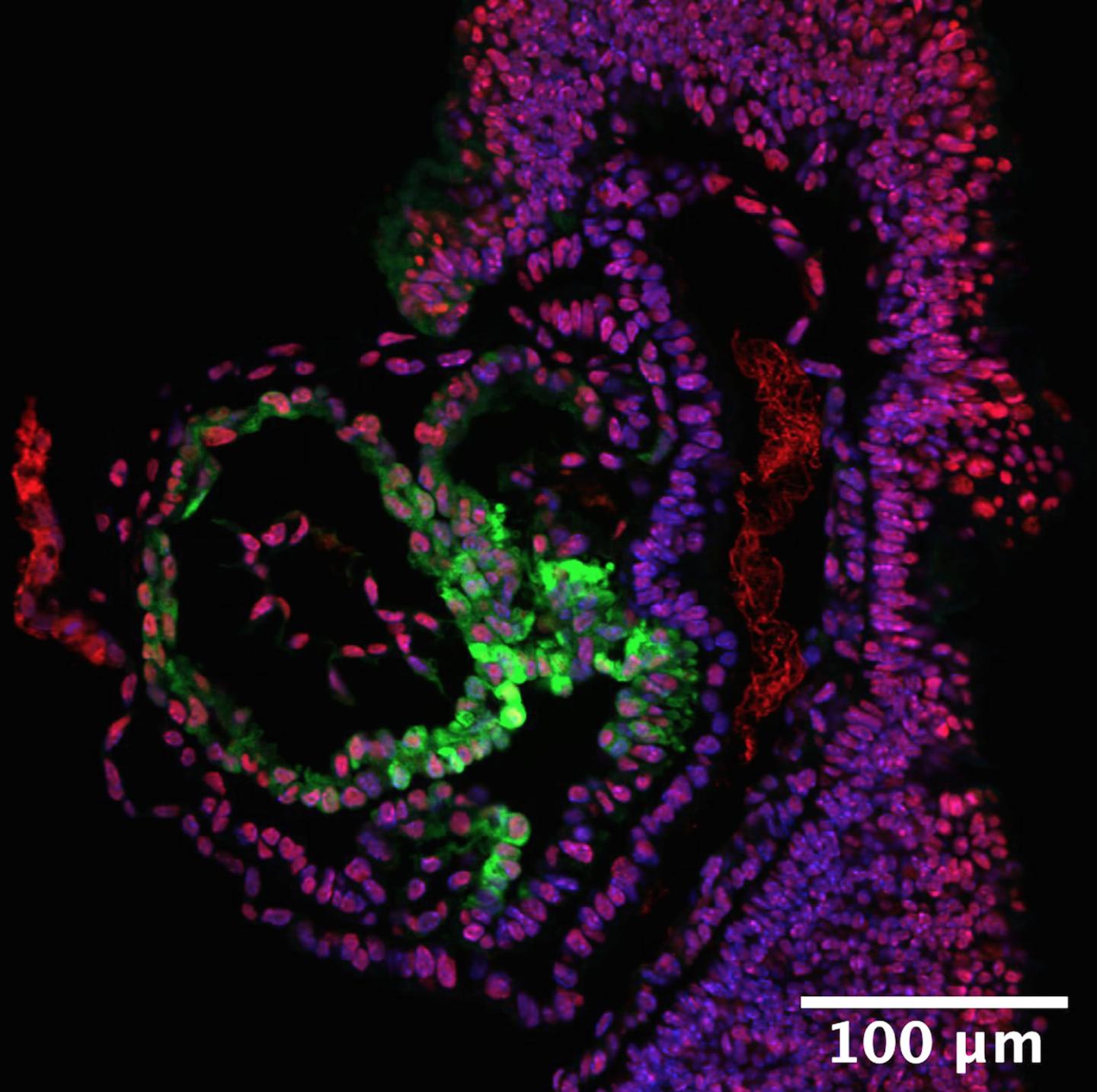 Early Expansion [IMAGE] | EurekAlert! Science News Releases