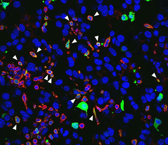 Houston Methodist researchers identify an imm | EurekAlert!