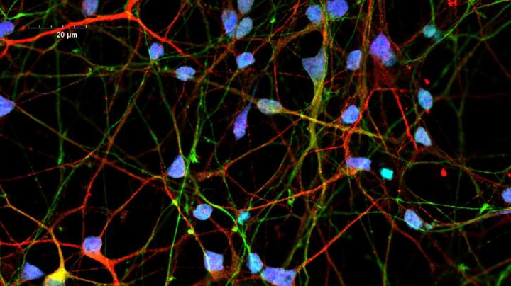 Neurons and Stem Cells in Pati [IMAGE] | EurekAlert! Science News Releases