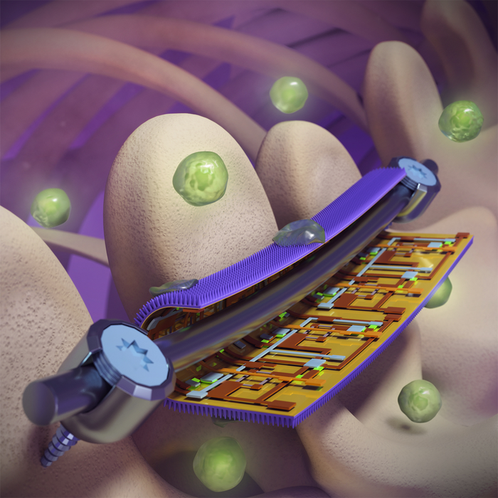 Smart orthopedic implant coati [IMAGE] | EurekAlert! Science News Releases