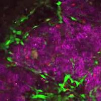 Active (Green) Cancer Cells Sp [VIDEO] | EurekAlert! Science News Releases