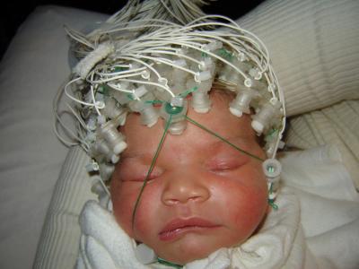 Electrodes on a Baby's Head [IMAGE] | EurekAlert! Science News Releases