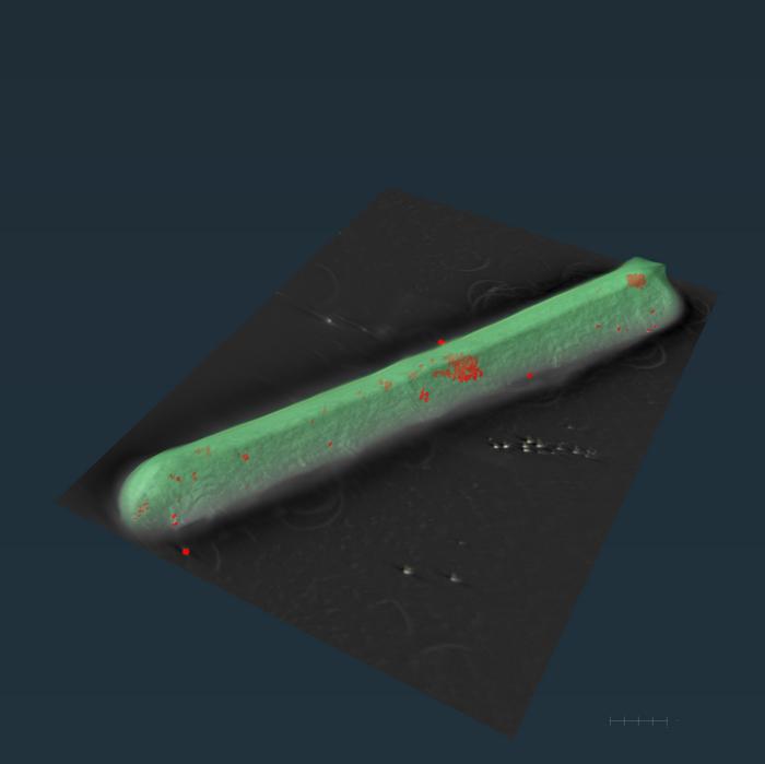 C. diff bacteria contain iron [IMAGE] | EurekAlert! Science News Releases