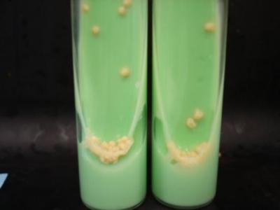 Culturing Tuberculosis Bacteri [IMAGE] | EurekAlert! Science News Releases