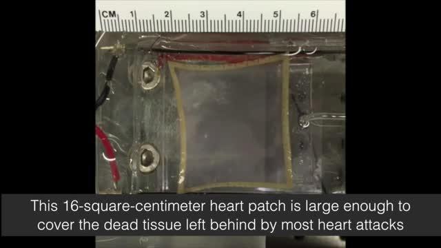 Beating heart patch is large enough to repair | EurekAlert!