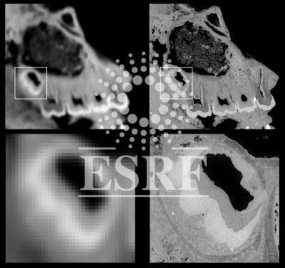 Teeth in CT and Synchrotron Mi [IMAGE] | EurekAlert! Science News Releases