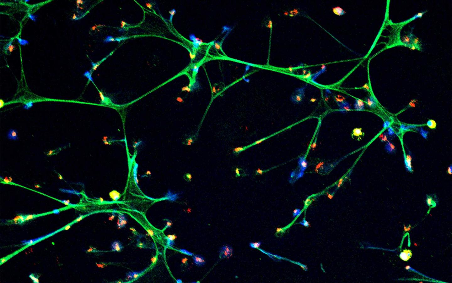 NETs [IMAGE] | EurekAlert! Science News Releases