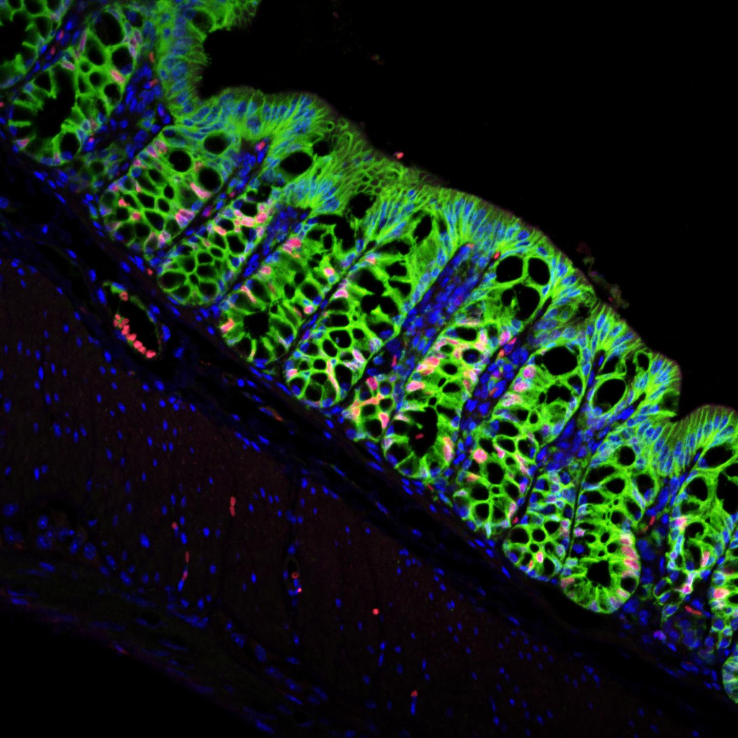 Colon of a Mouse with Normal S [IMAGE] | EurekAlert! Science News Releases