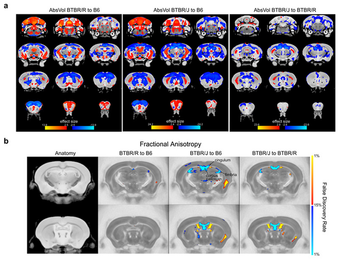 Figure 1: MRI scans showing br [IMAGE] | EurekAlert! Science News Releases
