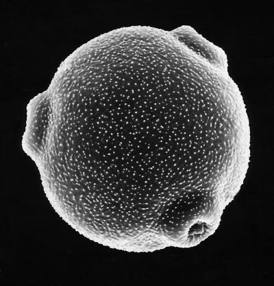 Birch Pollen [IMAGE] | EurekAlert! Science News Releases