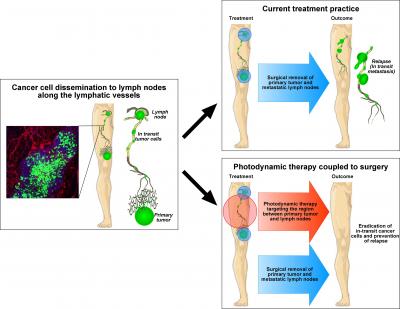 Laser Light Blocks Cancer Highway (2 of 3) | EurekAlert!
