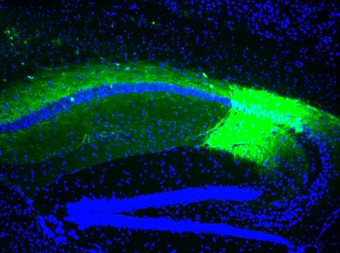 Major breakthrough identifies new mechanism f | EurekAlert!