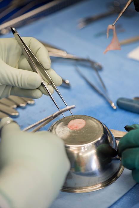 Cartilage transplant [IMAGE] | EurekAlert! Science News Releases