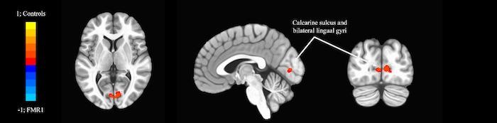 Different brain signals [IMAGE] | EurekAlert! Science News Releases