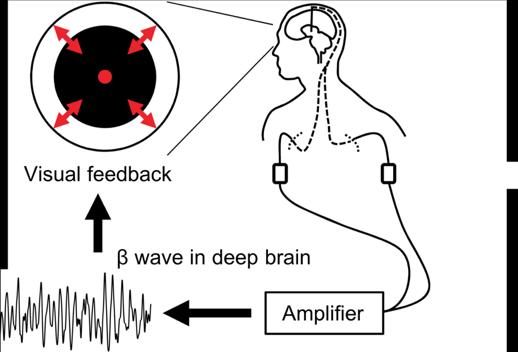 Figure 1: Real-Time Feedback S [IMAGE] | EurekAlert! Science News Releases