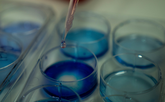 New and tailored lupus treatments within reac | EurekAlert!