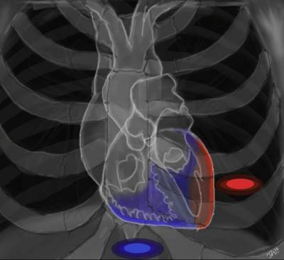UCLA Heart Schematic [IMAGE] | EurekAlert! Science News Releases