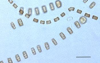 Thalassiosira [IMAGE] | EurekAlert! Science News Releases