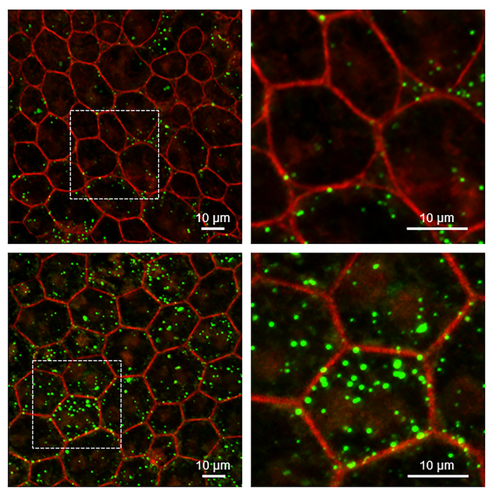 Retinal pigment epithelium in [IMAGE] | EurekAlert! Science News Releases