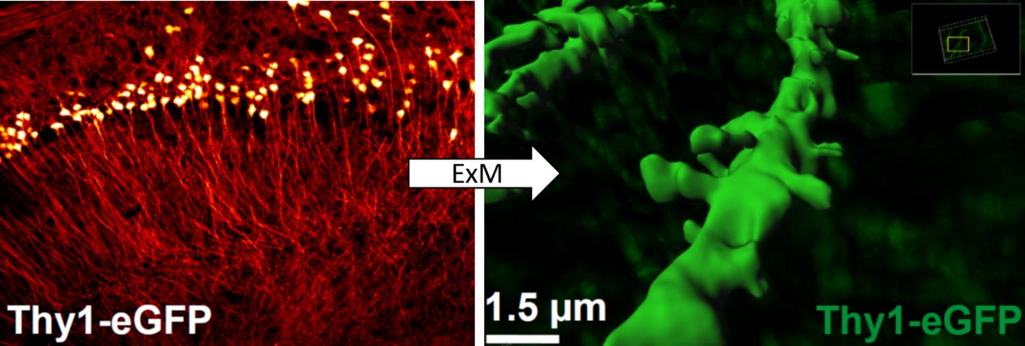 Super-resolution microscopy of neurons | EurekAlert!