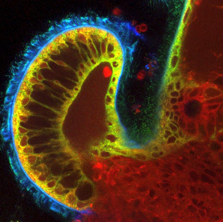 Cilia: 'The bouncer' of bacteria | EurekAlert!