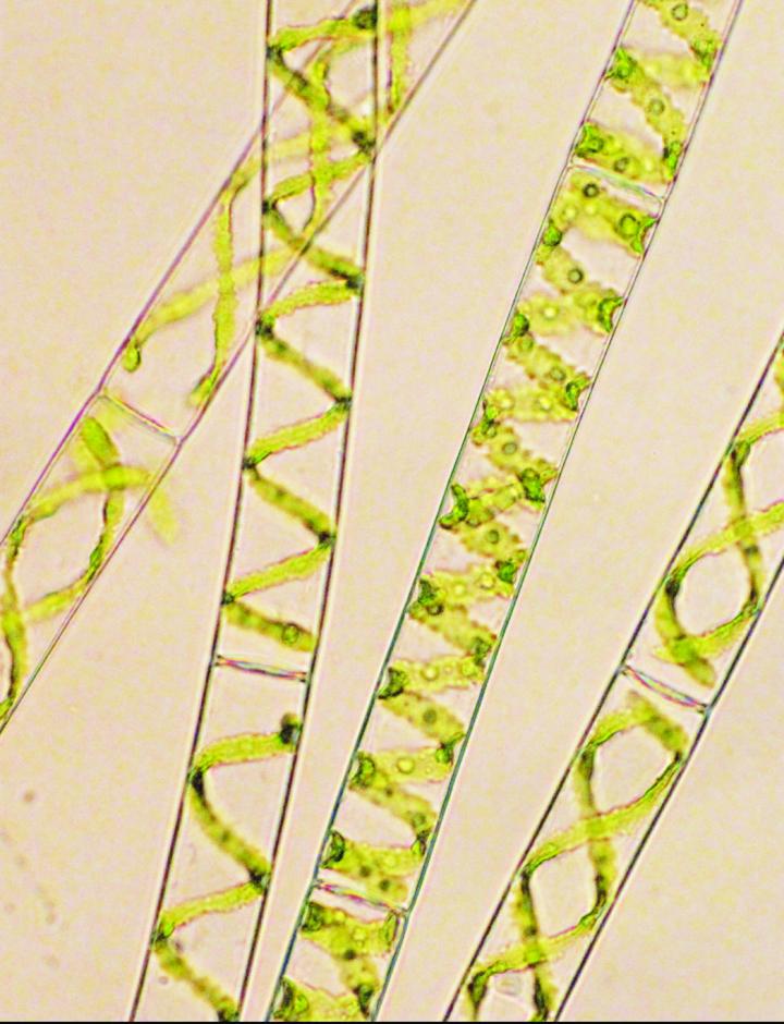 Spirogyra Algae Labeled