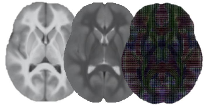 brain mri [IMAGE] | EurekAlert! Science News Releases