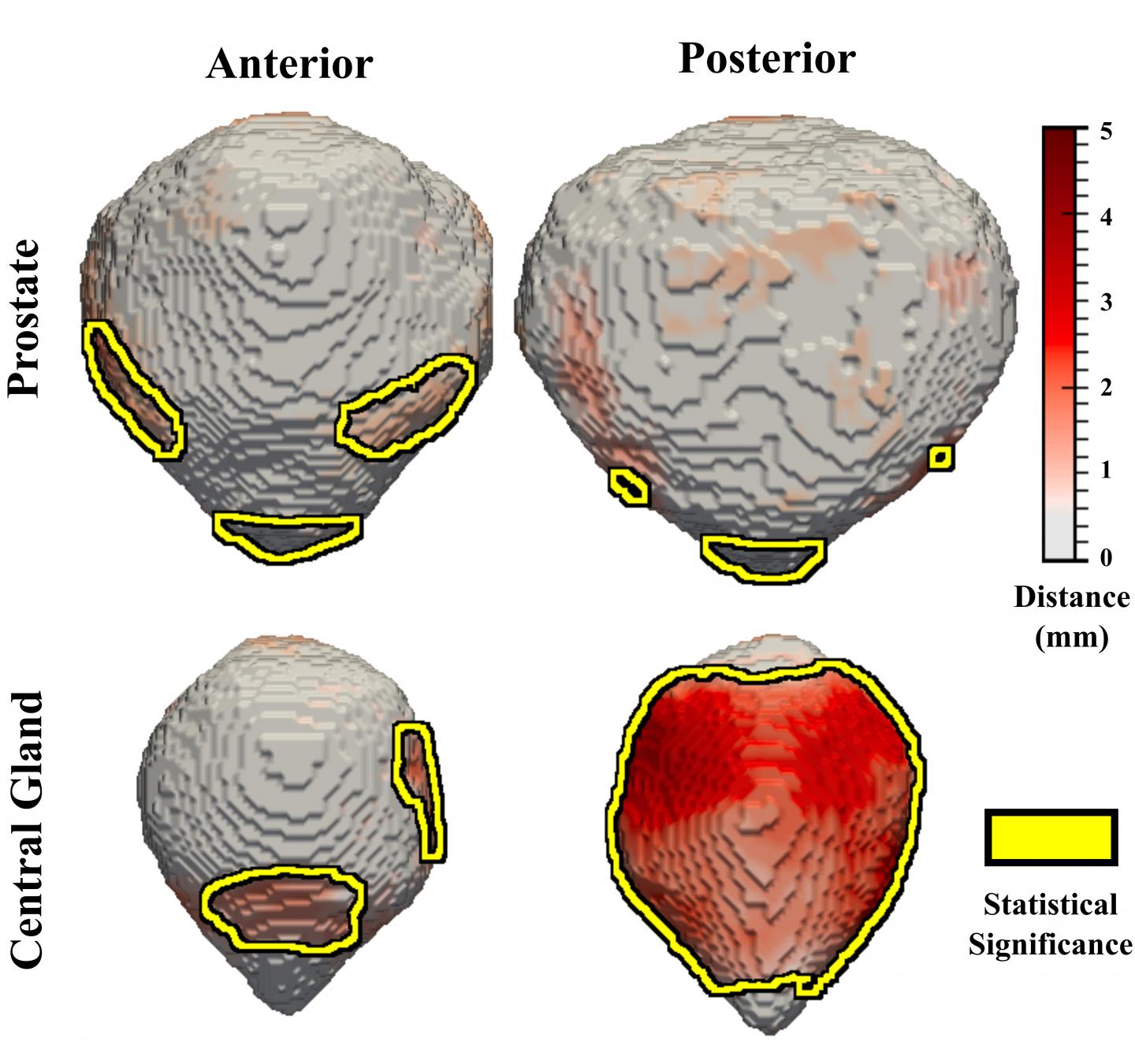 Atlas-Based Population Analysi [IMAGE] | EurekAlert! Science News Releases