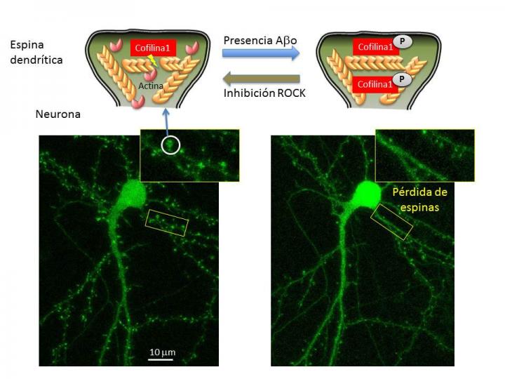 The cytoskeleton of neurons has been found to | EurekAlert!