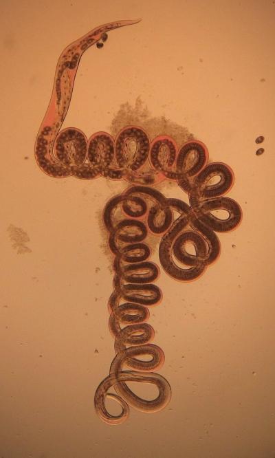 Helminth [IMAGE] | EurekAlert! Science News Releases