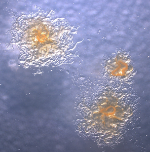 Flavobacterium columnare [IMAGE] | EurekAlert! Science News Releases