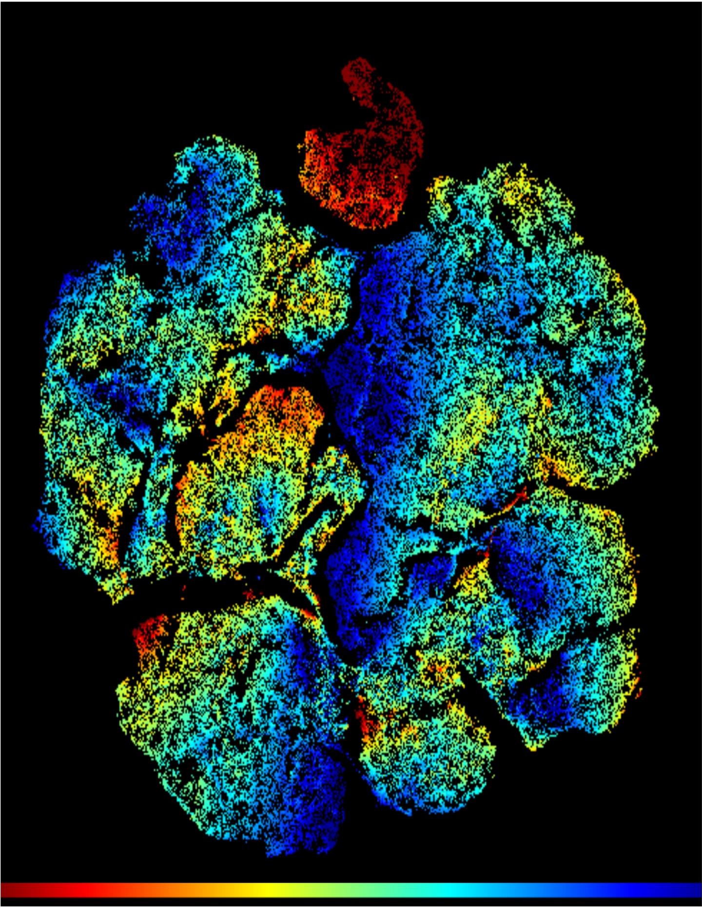 Researchers identify possible pathway to rebo | EurekAlert!