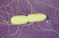 Antibiotic resistance: An unexpected chronolo | EurekAlert!